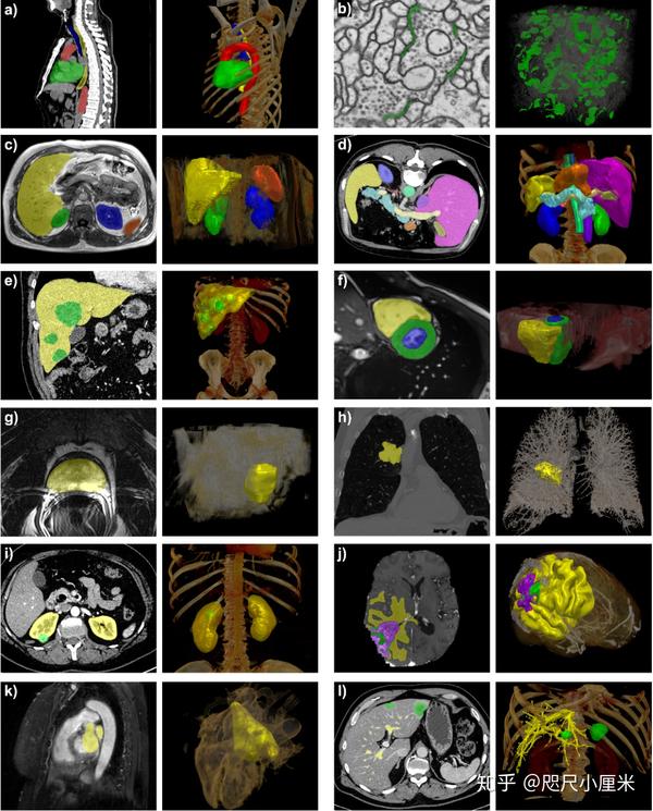 [论文总结] nnUnet - 知乎