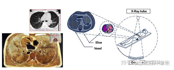 什么是CBCT？它和CT有什么区别？ - 知乎