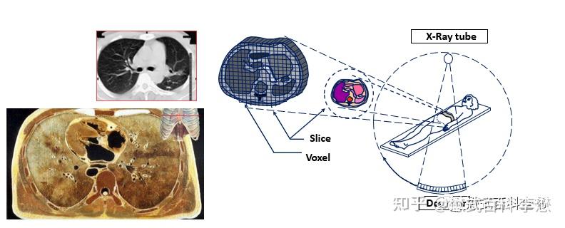 什么是CBCT？它和CT有什么区别？ - 知乎