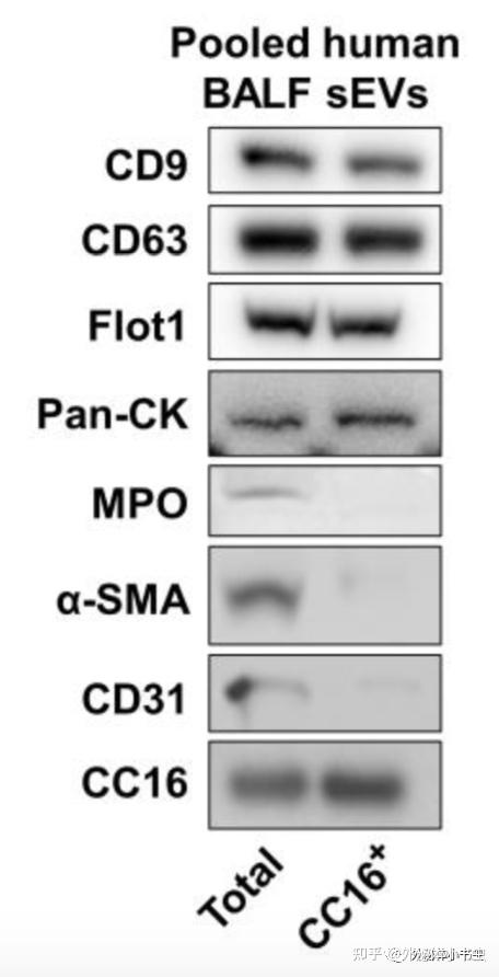 文献分享【Mol. Ther.】外泌体装载CC16蛋白治疗肺急性炎症反应 - 知乎