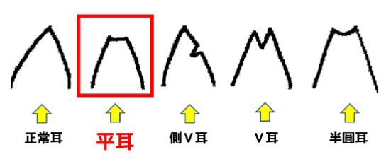 【绝育代替扑杀】捕捉-结扎-原地放回，TNR绝育计划的3大好处！ - 知乎