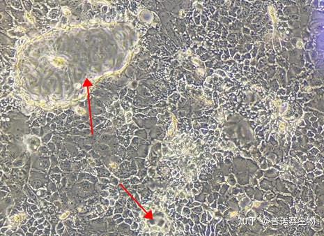 细胞学堂 | Caco-2细胞生长特性和常见问题解决策略 - 知乎