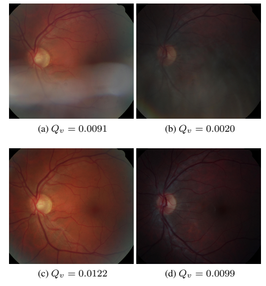 HRF Image Quality Assessment Dataset 数据集介绍 - 知乎