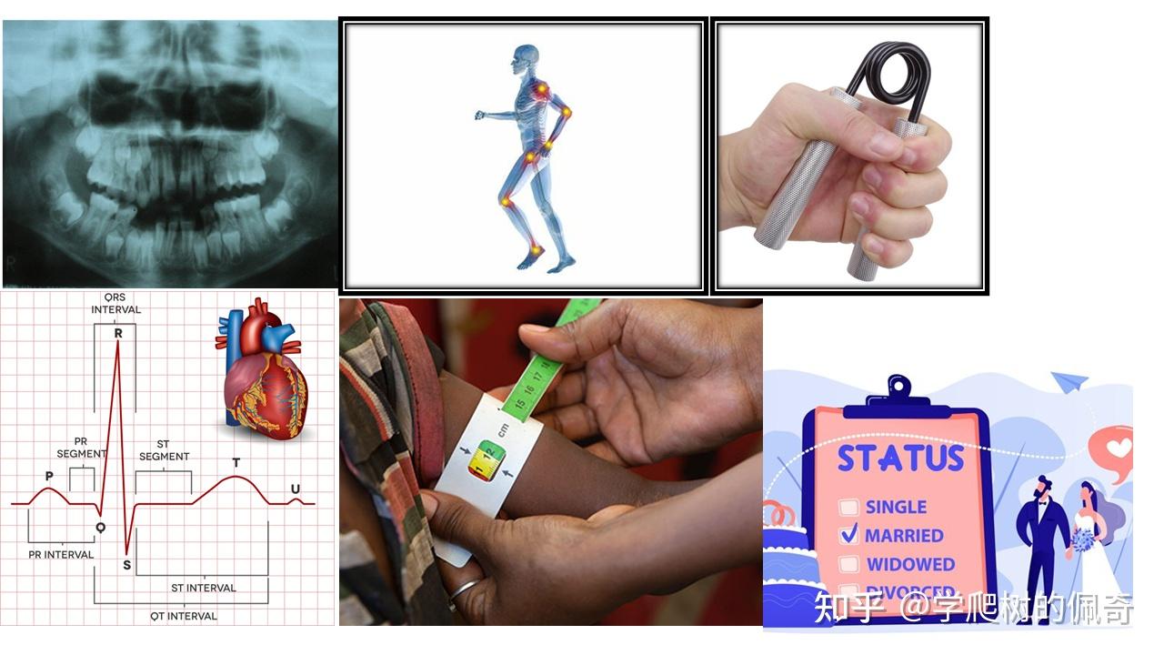 NHANES数据库练手DAY13(骨质疏松的危险因素) - 知乎