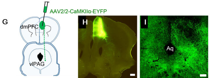 【客户文章】空军军医大学李云庆教授、董玉琳副教授团队在dmPFC-vlPAG投射神经元参与疼痛维持阈值和抗焦虑行为研究取得新进展 - 知乎