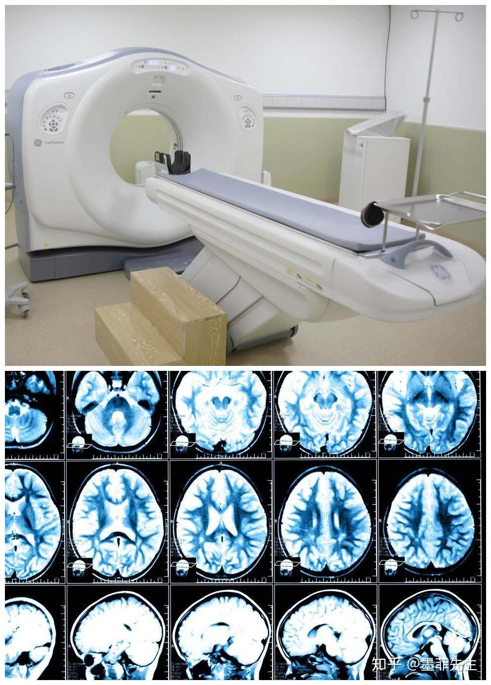 B超、DR、CT、MRI是什么东西？