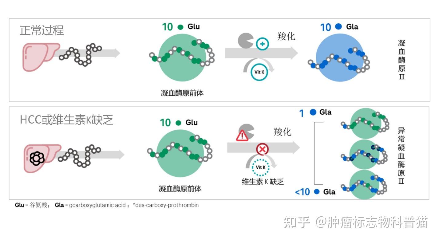 肿瘤标志物科普系列--异常凝血酶原（PIVKA-II）升高原因分析 - 知乎