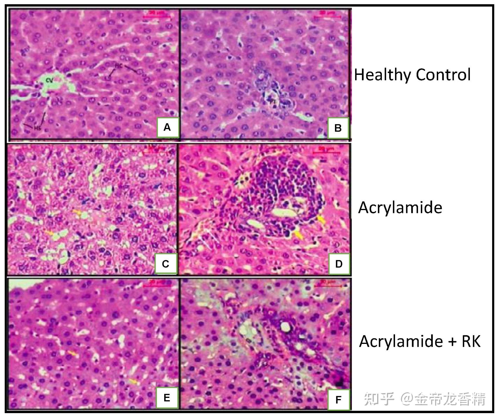 香精与香料(71)—覆盆子酮(Raspberry ketone) - 知乎