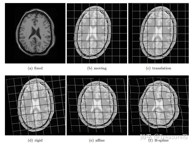 Python科研图像处理——PyElastix非刚性配准 - 知乎