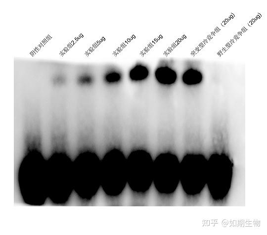 EMSA实验方法及检测报告模板 - 知乎