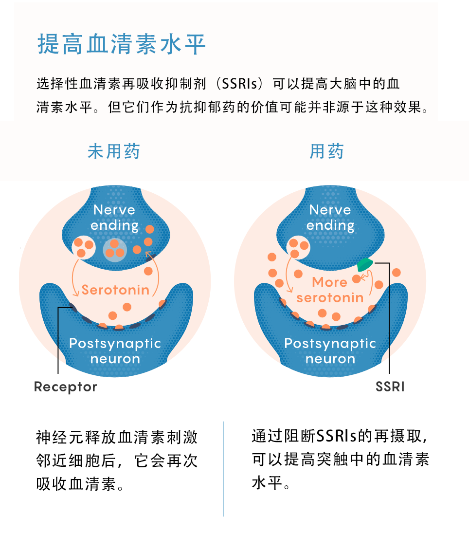 化学失衡之外，重新发现抑郁症 - 知乎