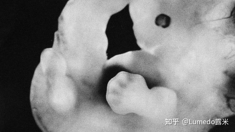 Danny roddy：亚里士多德的散热器，或：背景下的头发生长（二氧化碳、血清素和老龄化的全球降温) - 知乎