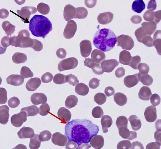 DiI、DiO、DiD、DiR这些细胞膜染料之间的区别 - 知乎