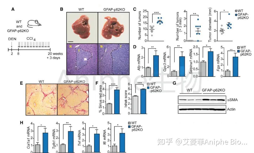 疾病模型 | 肝纤维化(HF)与肝纤维化肝癌（HCC）（下） - 知乎