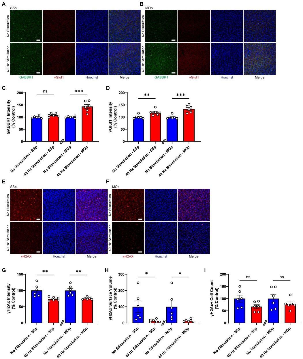 MIT蔡立慧团队最新报道40Hz震动刺激改善AD病理和运动表现 - 知乎