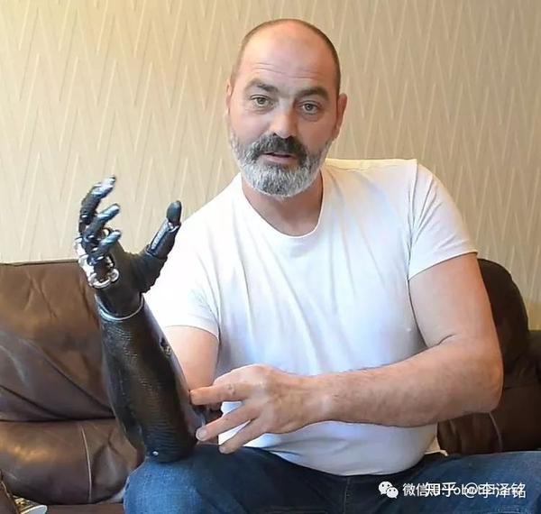 智能假肢：生肌电控制机器人手臂 - 知乎