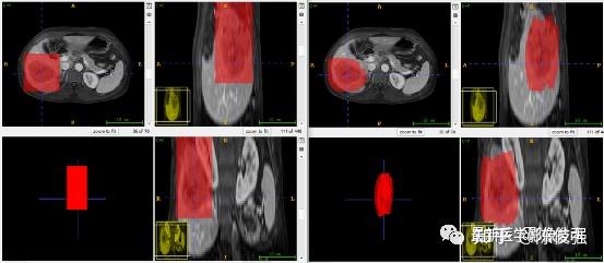 LLD-MMRI2023——多模态MRI 的肝脏病变诊断挑战 - 知乎