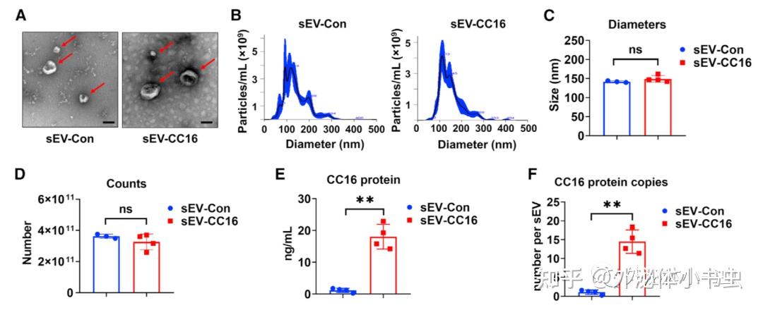 文献分享【Mol. Ther.】外泌体装载CC16蛋白治疗肺急性炎症反应 - 知乎