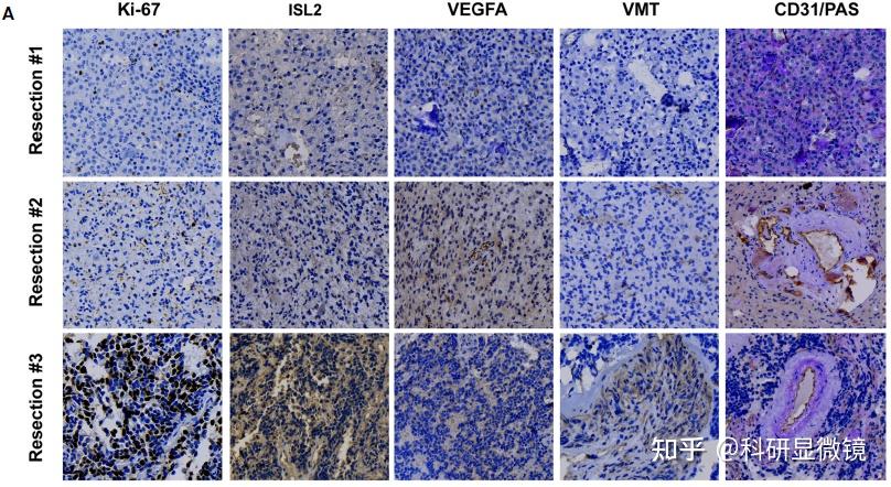 活久见系列！这到底是机制研究还是case report？ - 知乎