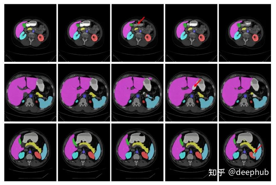 LeViT-UNet：transformer 编码器和CNN解码器的有效整合 - 知乎