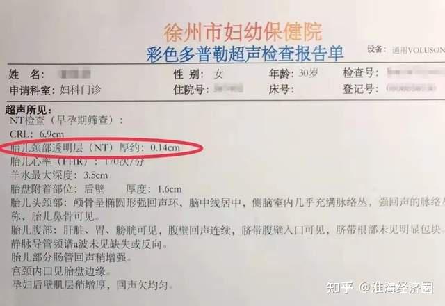 【科普】一口气教您读懂超声NT报告 - 知乎
