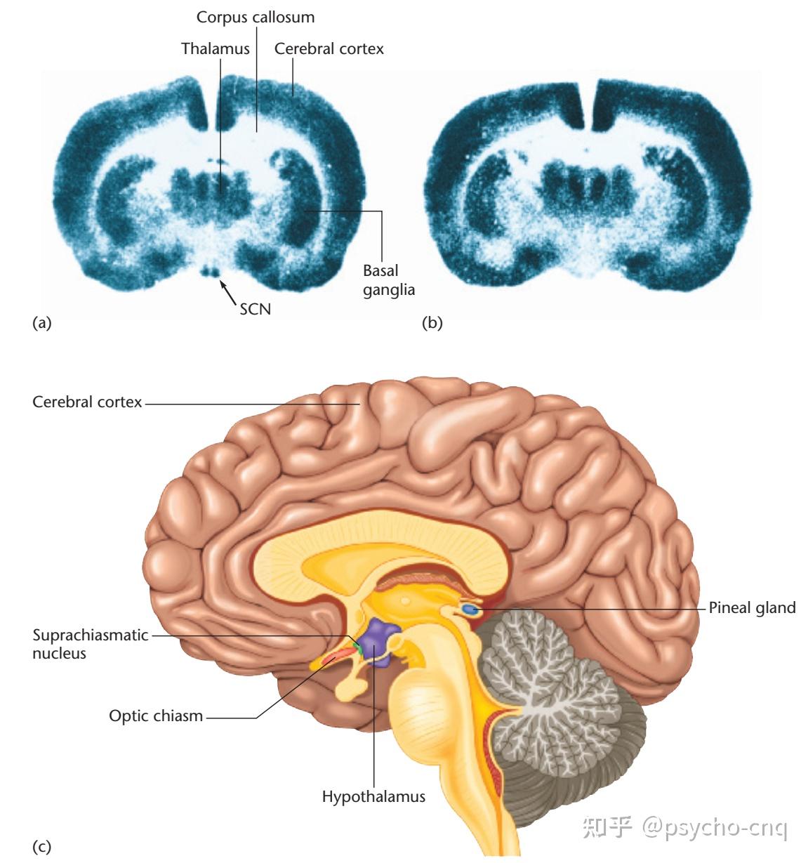 睡眠与觉醒 - 知乎