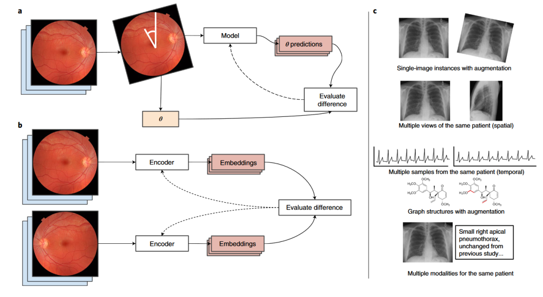 Nat. Biomed. Eng.| 综述：医学和医疗保健中的自监督学习 - 知乎