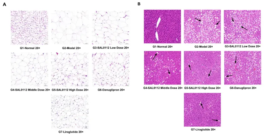 文献解读|新型GLP-1受体偏向激动剂SAL0112的药效学和药代动力学特征 - 知乎