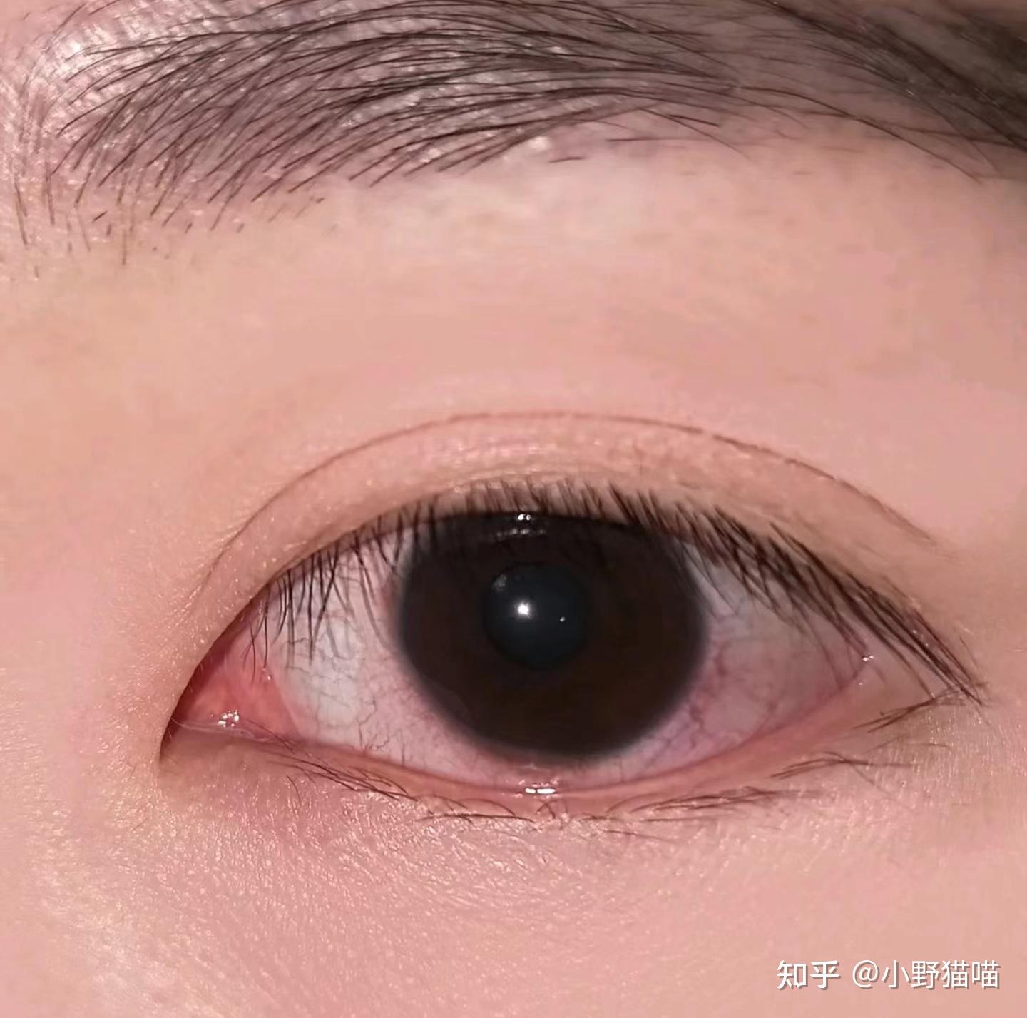 每天对着电脑工作和学习，长时间用眼真的可以靠叶黄素保护眼睛吗？