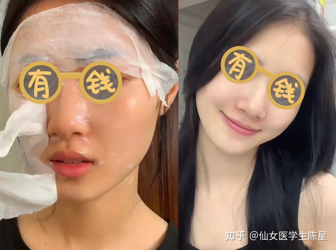 【皮肤科医生】2023详细美白攻略皮肤蜡黄、暗沉、天生黑、晒黑通通解决!认准这3点,28天让皮肤白到发亮! 知乎