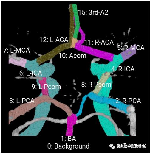 Top_Cow 2023——用于CTA和MRA的Willis环的拓扑解剖结构分割在测试集上docker推理结果 - 知乎