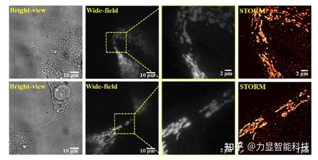 用STORM成像揭示细胞间隧道纳米管（TNTs）的结构和组织 - 知乎