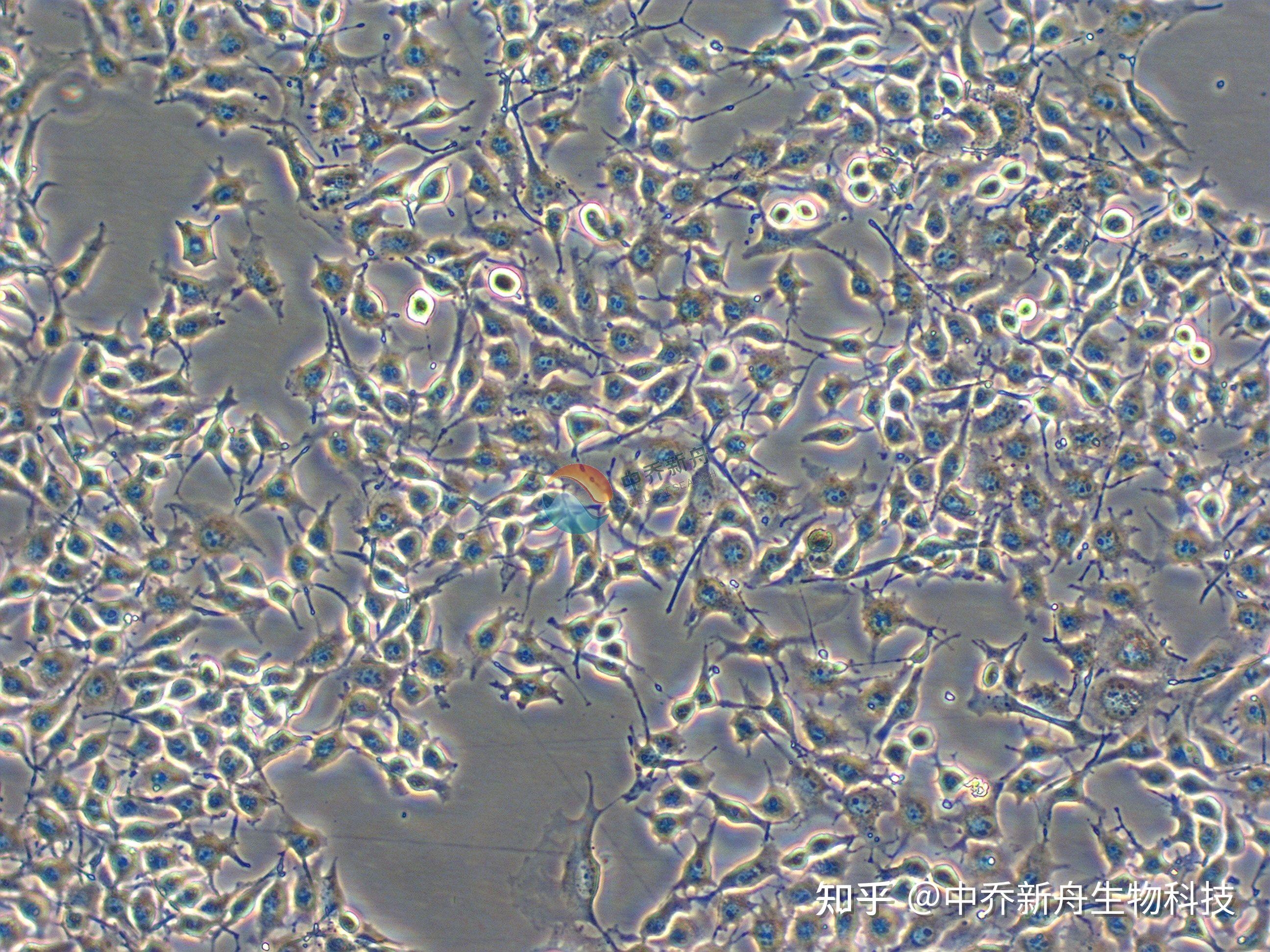 绝不能错过：B16-F10小鼠黑色素瘤高转细胞培养完美攻略 - 知乎