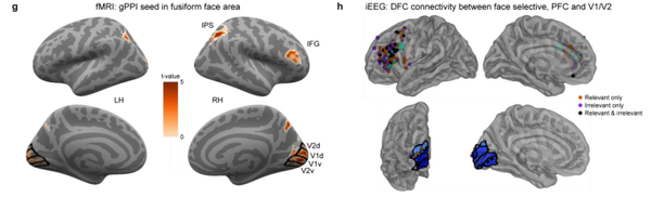 IIT vs GNWT：意识理论对比检验 - 知乎