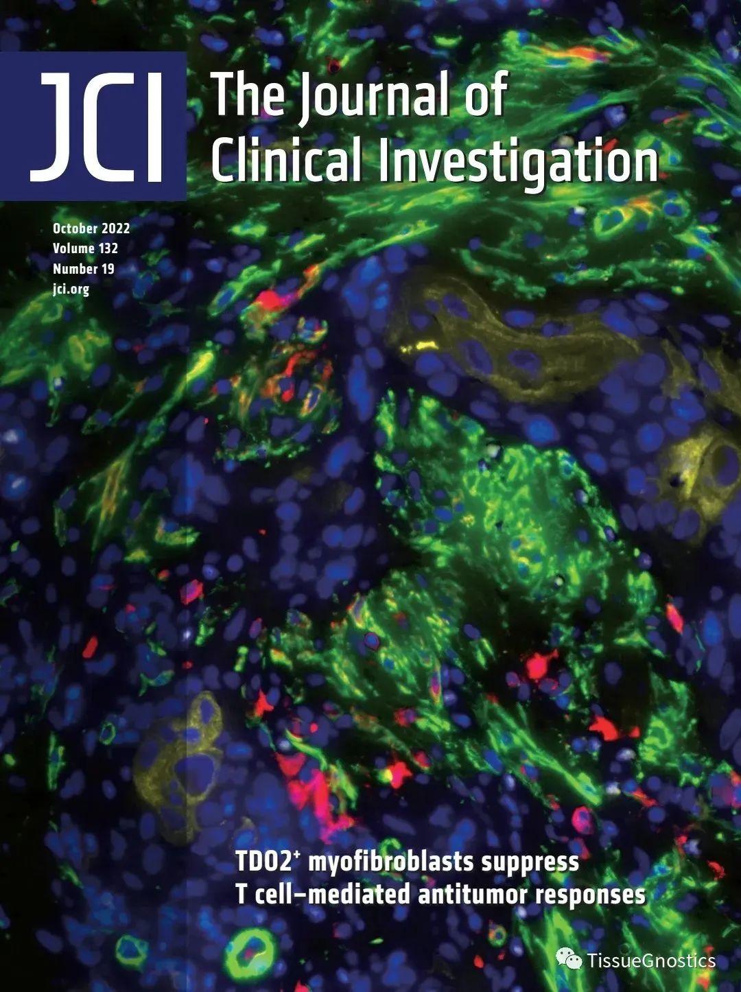 JCI封面文章| 中山大学北京大学联合揭示口腔肿瘤免疫逃逸机制和新的治疗靶点 - 知乎