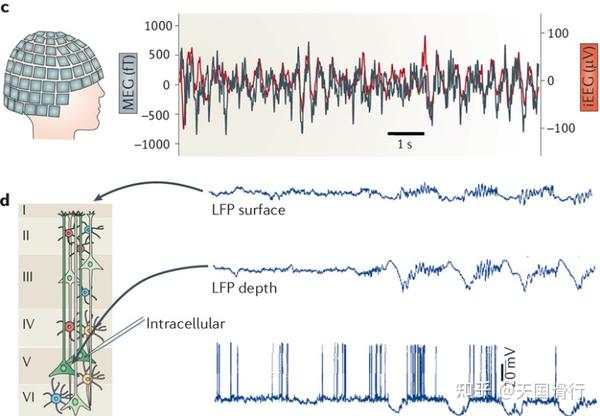 EEG 和 LFP 相互关系的动态展示 - 知乎