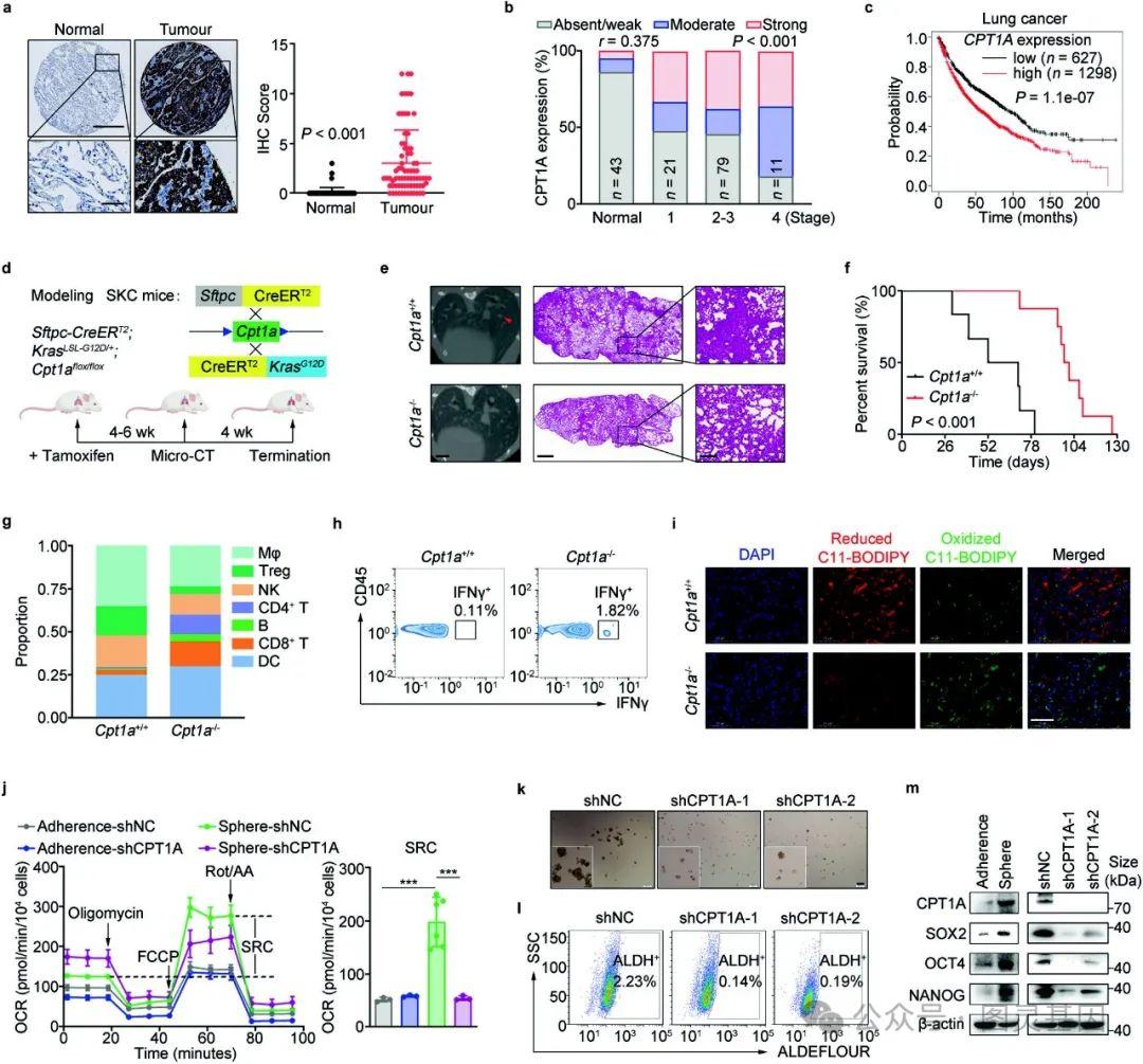 STTT | 靶向CPT1A可诱导铁死亡并与肺癌免疫治疗产生协同作用 - 知乎