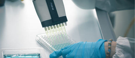 Simoa测定表征和验证方法——检测极限和定量下限（Part 1）-上海玮驰仪器有限公司