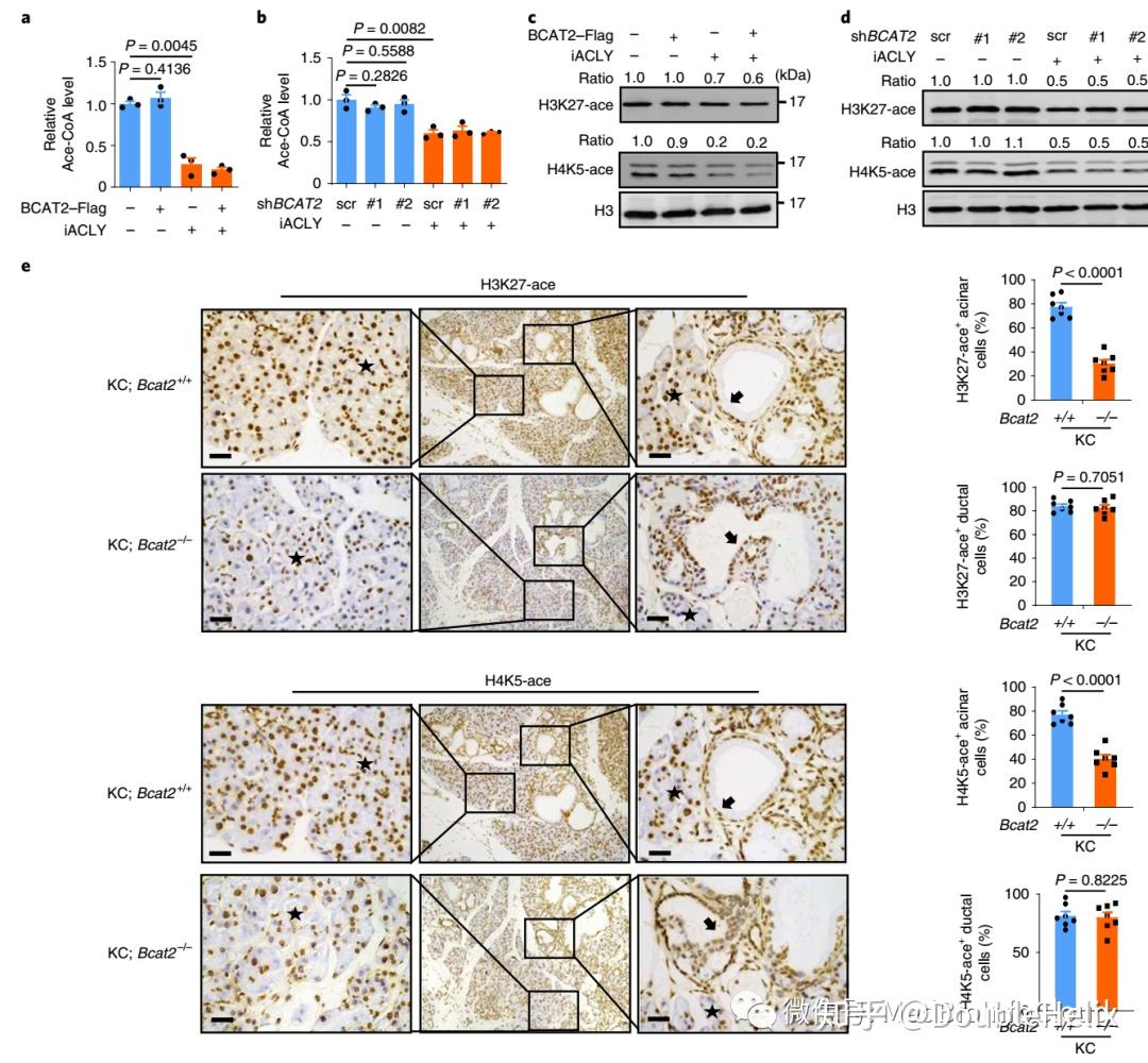 Nature子刊|BCAT2介导的BCAA分解代谢是胰腺导管腺癌发生发展的关键 - 知乎