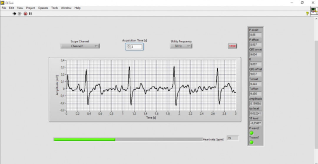 干货分享 | 使用ADS基础实验平台和LabVIEW 搭建心电图测试仪 - 知乎