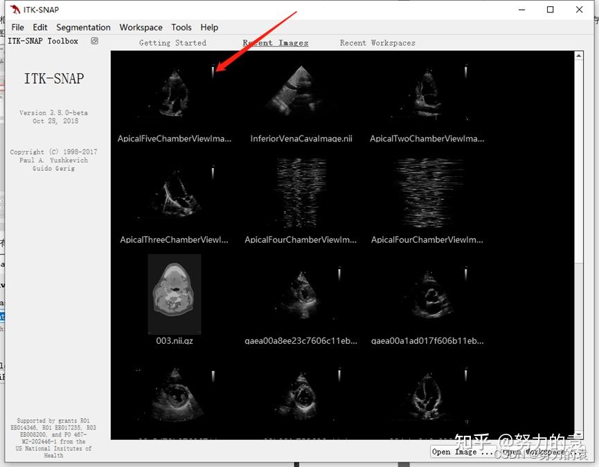 【图像分割】ITK-SNAP分割标注教程 - 知乎
