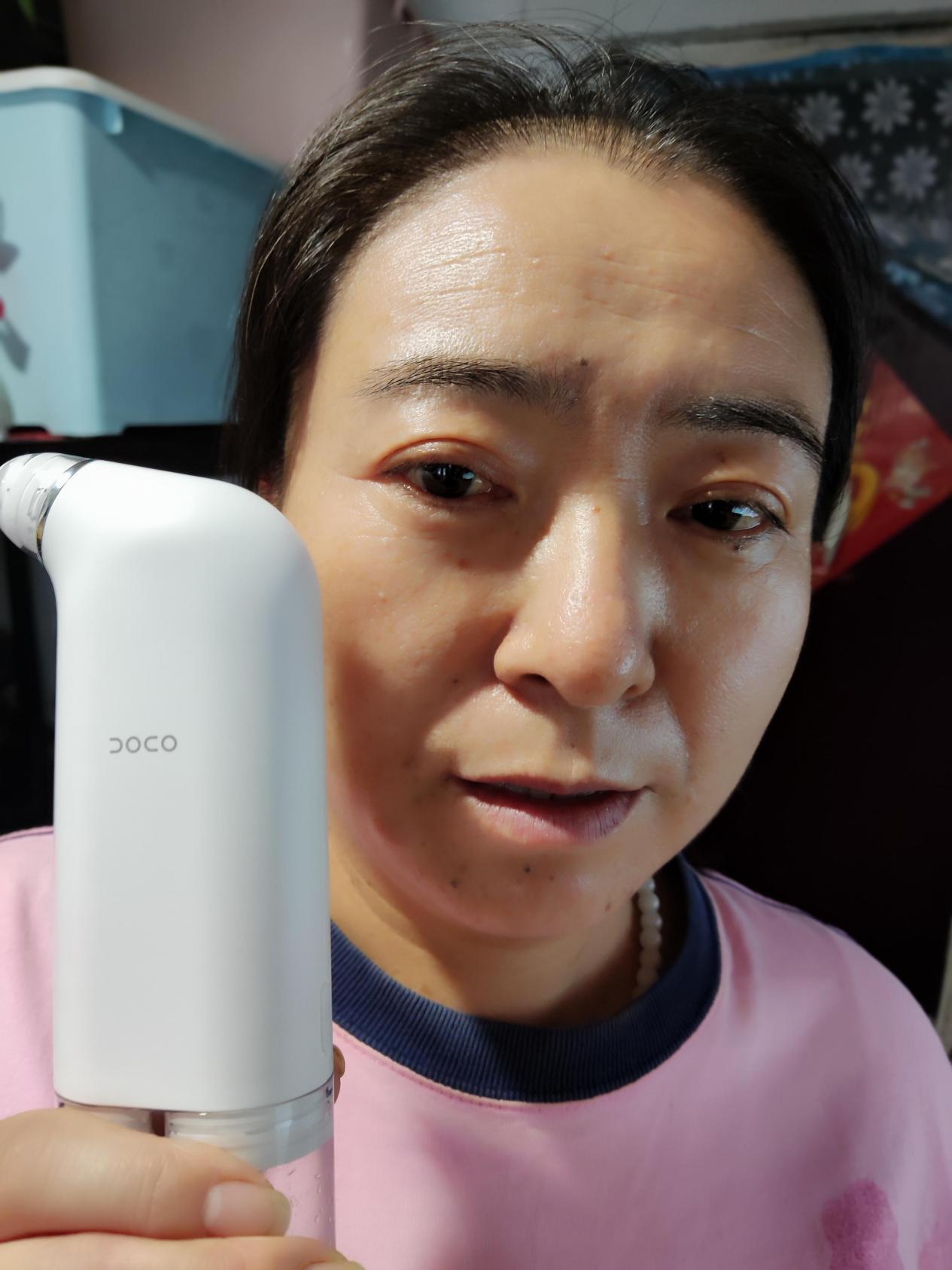 脸部吸尘器-DOCO超微小气泡毛孔护理器 - 知乎