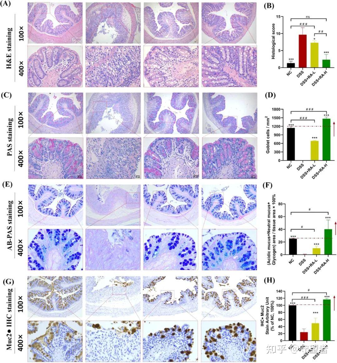 Journal of Agricultural and Food Chemistry封面：迷迭香酸通过调节肠道微生物衍生代谢物和炎症小体的激活 ...
