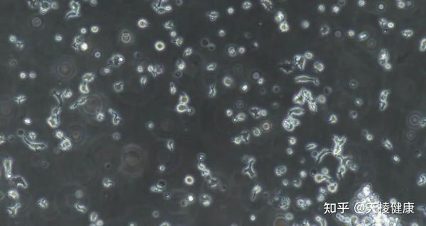 “全能型”NK细胞 消灭肿瘤、抵御病毒、对抗衰老一肩挑 - 知乎