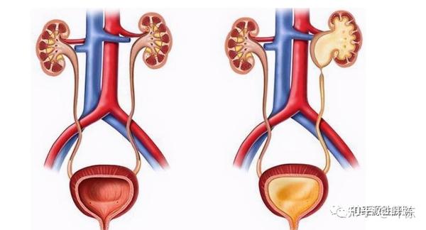 神经源性膀胱 - 知乎