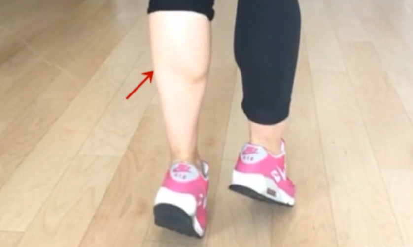 如何减小腿肌肉？ 知乎