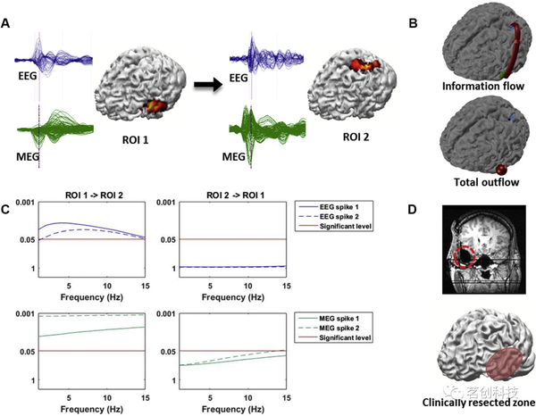 EEG源定位 - 知乎