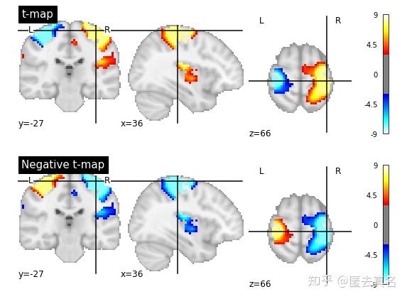 nilearn 笔记（15） - 知乎