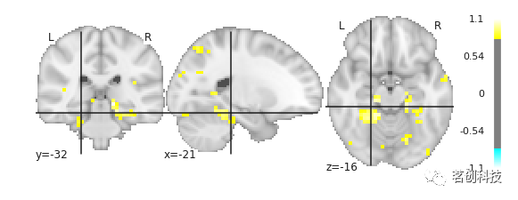 fMRI连接性分析 - 知乎