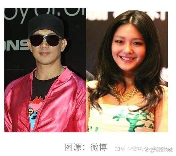 46岁大s再婚:为何她对光电抗衰情有独钟 知乎